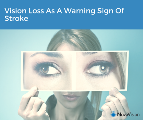 Vision Loss as a Warning Sign of Stroke - NovaVision